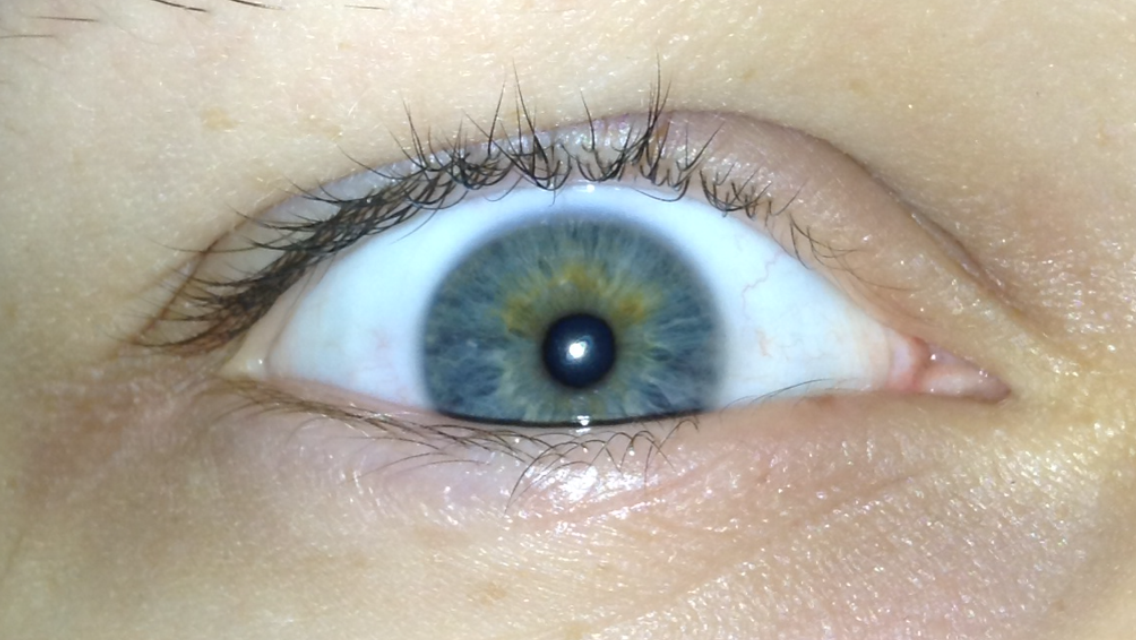 Page 4 of comments at Heterochromia